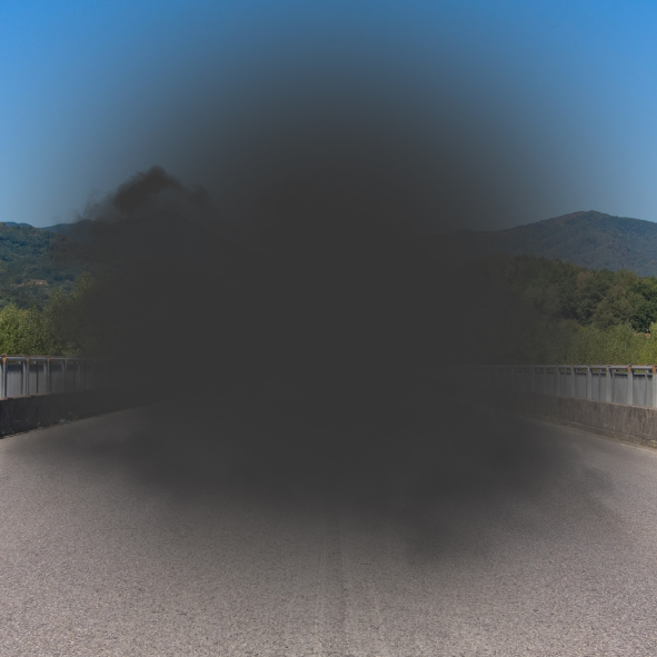 Age-related macular degeneration (AMD) - Retina Australia